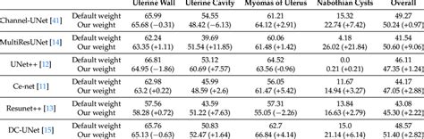 Comparison Of Segmentation Results Of Representative Models In Default