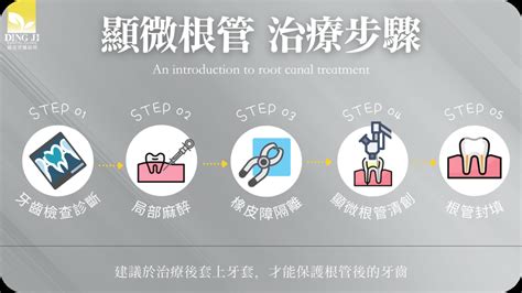 顯微根管 鼎吉牙醫診所
