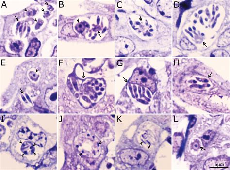 Cyclospora Intestine