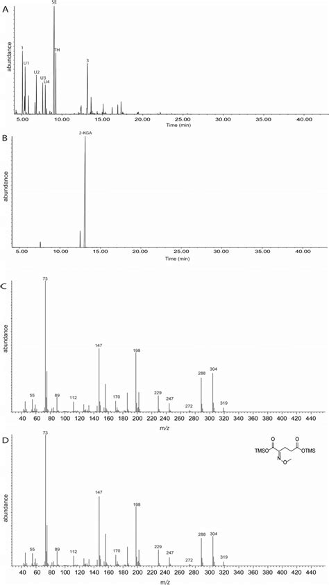A Gc Chromatogram Of Methoxyaminated And Bstfa Derivatized Fractions Download Scientific