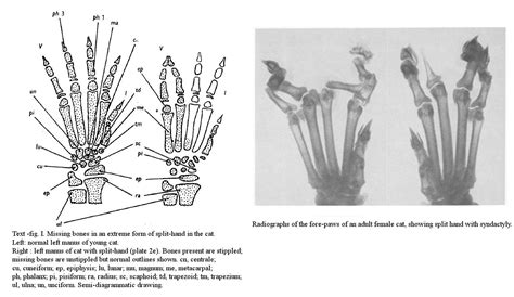 Cats Paw Anomalies Syndactyl Oligodactyl Brachydactyl