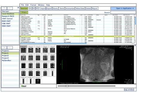 slicer3 uidesign workingproblems slicer consolidated load gui design slicer wiki
