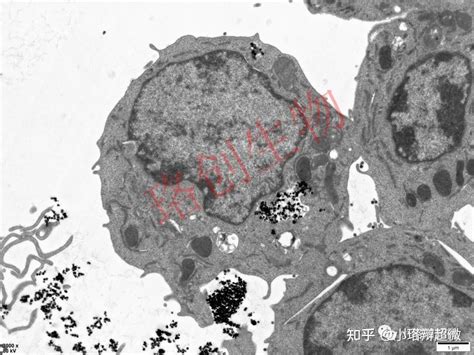 第十四期：透射电镜下的细胞吞噬纳米材料 知乎