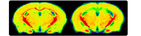 Cuprizone Models Of Multiple Sclerosis Ms Biospective