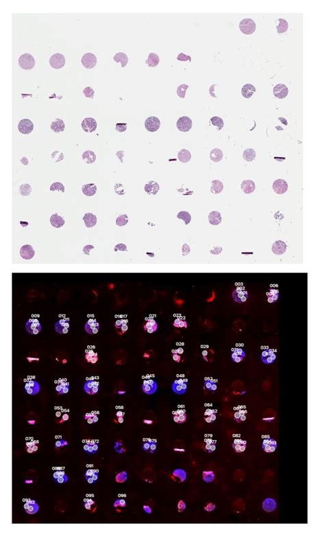 Digital Spatial Profiling For Characterization Of The Microenvironment