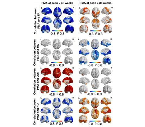 Correlation Between Cortical Diffusion Characteristics And Age At Scan Download Scientific