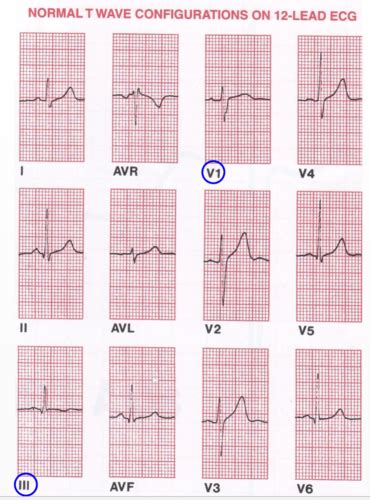 Lectures 3 And 4 Flashcards Quizlet