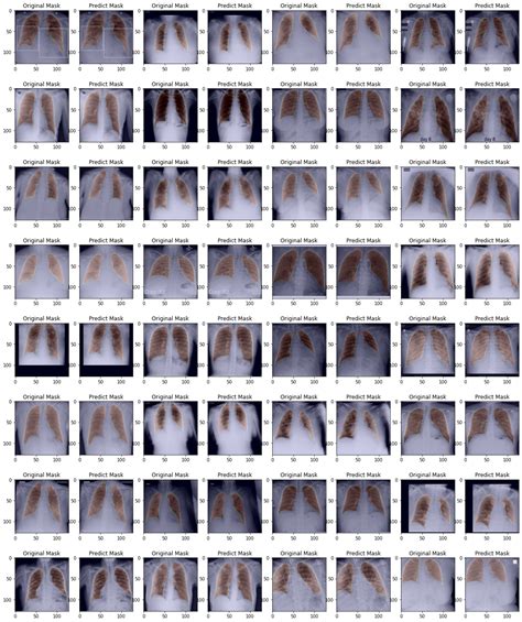 Github Kaledhoshme123probabilistic U Net Segmentation Ambiguous