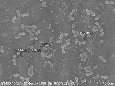 The Scanning Electron Microscope Image Of Lactococcus Sp Download