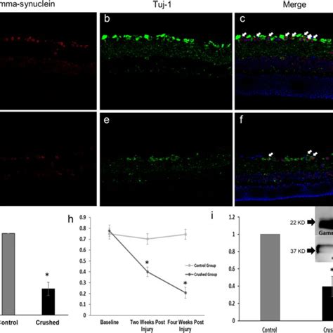 Gamma Synuclein Positive Cells Are Accumulated At The Optic Nerve Crush Download Scientific