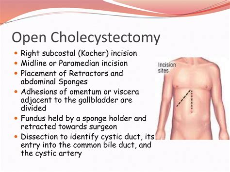 Open Vs Laparoscopic Cholecystectomy Pptx