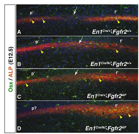 Regulation Of Cranial Morphogenesis And Cell Fate At The Neural Crest Mesoderm Boundary By