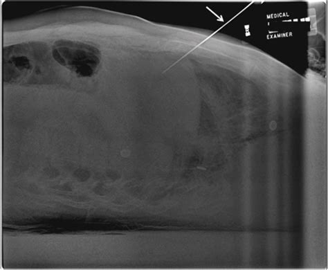 Digital Image Receptor Systems