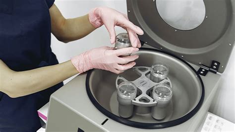 პლაზმოლიფტინგის პროცედურა