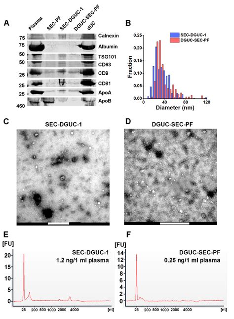 Comparison Of Sevs Isolated By Sec Dguc And Dguc Sec Protocols A