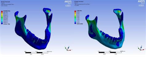 Strain Distribution On Left And Stress Distribution On Right Of Download Scientific Diagram