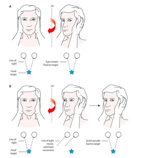 Hints Exam — Maimonides Emergency Medicine Residency