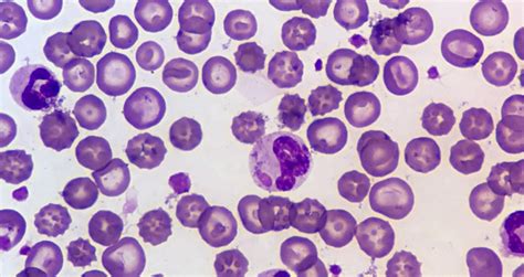 Single Cell Protein And Uses Of Single Cell Protein Scp