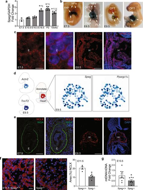 横纹优先表达基因缺陷导致发育中的心肌细胞线粒体功能障碍basic Research In Cardiology X Mol