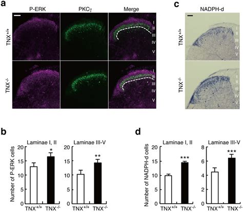 Central Sensitization In The Spinal Dorsal Horns Of Tnx −− Mice Ab