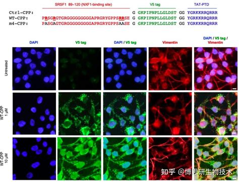 Stm｜改善神经退行性疾病病变的新策略——细胞可渗透性多肽阻止c9orf72重复性扩展转录本的核输出 知乎