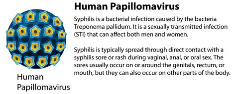 인간 유두종바이러스설명 포함 무료 벡터