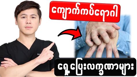 −− ကျောက်ကပ် ရှေ့ပြေးလက္ခဏာ ၉ မျိုး −− Youtube