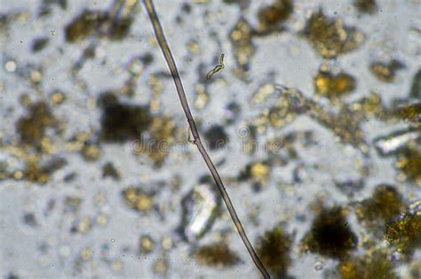 Microorganismos Del Suelo En Una Muestra De Suelo Hongos Y Bacterias En