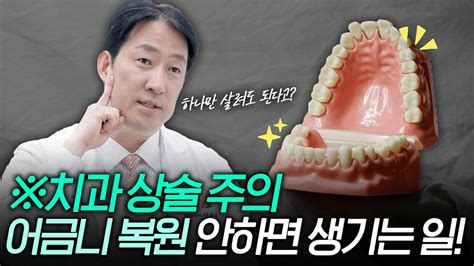 임플란트 어금니 하나만 있어도 된다고 어금니 복원이 중요한 이유 Youtube