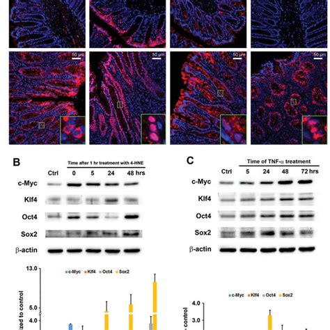 Dclk1 Expression Is Increased In Human Colon Adenomas And Colorectal