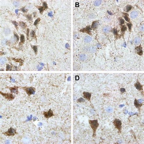 Gaba A Receptor Subunit Y Protein Distribution In Sections Of Download Scientific Diagram