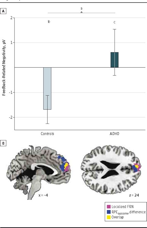 Figure 1 From Role Of The Medial Prefrontal Cortex In Impaired Decision Making In Juvenile
