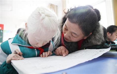 11岁白化病女孩视力仅0 04，同学争当她的“眼睛” 傲雪 同学 白化病 新浪新闻