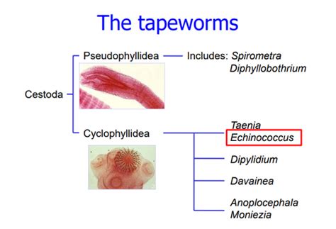 5 Hydatid Disease And Echinococcus Flashcards Quizlet 5 Hydatid Disease And Echinococcus Flashcards Quizlet