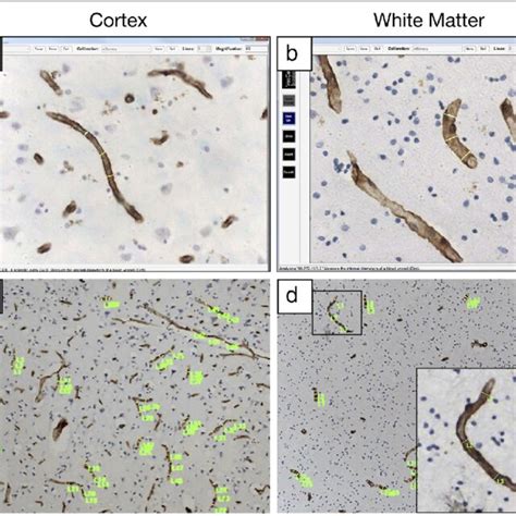 Methods Used To Quantify Microvascular Morphology A D Representative Download Scientific