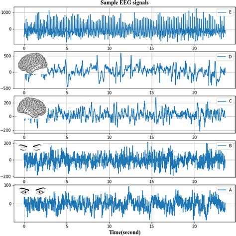 Sample Eeg Time Series From Each Of The Five Sets Represent Set E To Download High Quality