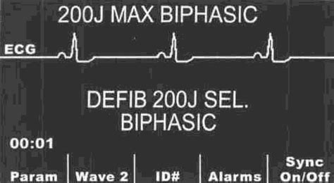 Выбор мощности дефибриллятора Дефибриллятор Zoll «двухфазовый