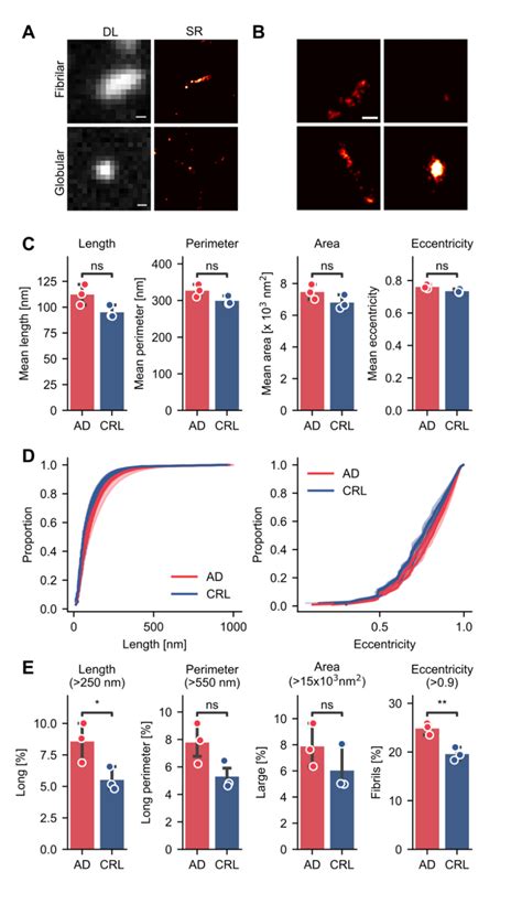 Characterizations Of Brain Derived Tau Aggregates Using Simpull Coupled