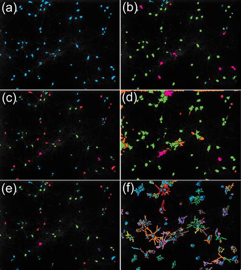 Detected Rois For Dataset 3 Using Various Segmentation Strategies