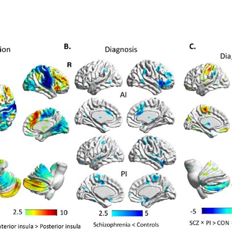 Altered Resting State Functional Connectivity Of The Anterior And