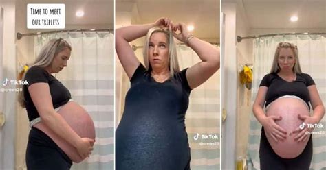 20 Weeks Pregnant With Triplets