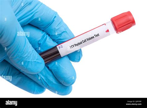 PCV Packed Cell Volume Test Medical check up test tube with biological ...