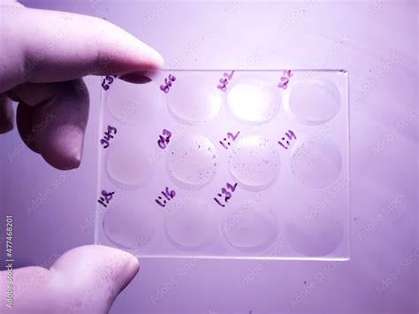 Rpr Vdrl Syphilis Test Glass Slide Agglutination 47 Off