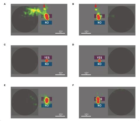 A Heat Map Of Gaze Shifts Of The Patient With Homonymous Hemianopia