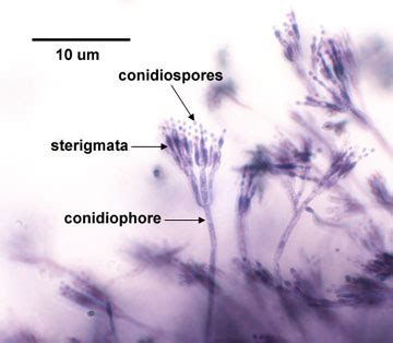 BIOL 230 Lecture Guide Conidiospores Of Penicillium