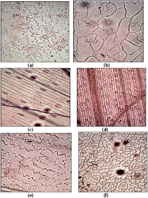 Plant Epidermal Cell