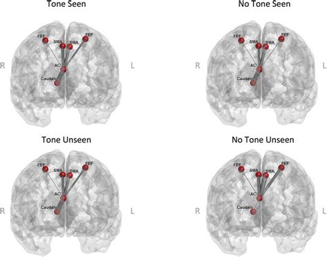 Pairwise Functional Connectivity For Regions Demonstrating A Download Scientific Diagram