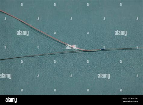 Optical Coherence Tomography Oct Was Performed Measurement Of