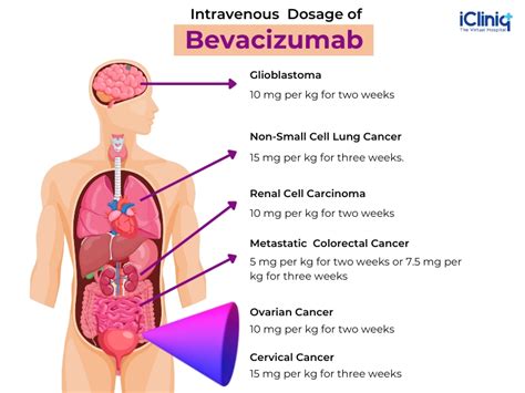 What Is Bevacizumab Vikg At Maria Cardenas Blog