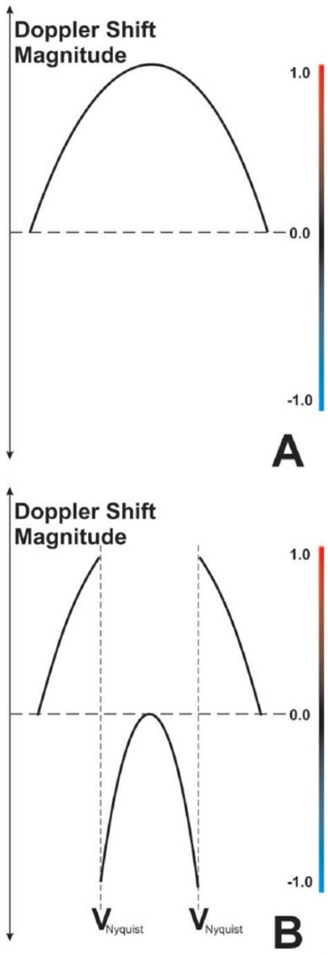 Under Ideal Conditions Doppler Signals Would Be Below The Nyquist